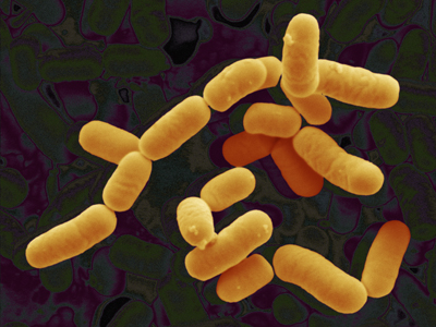 Lactobacillus GG may decrease risk of nosocomial respiratory and GI ...