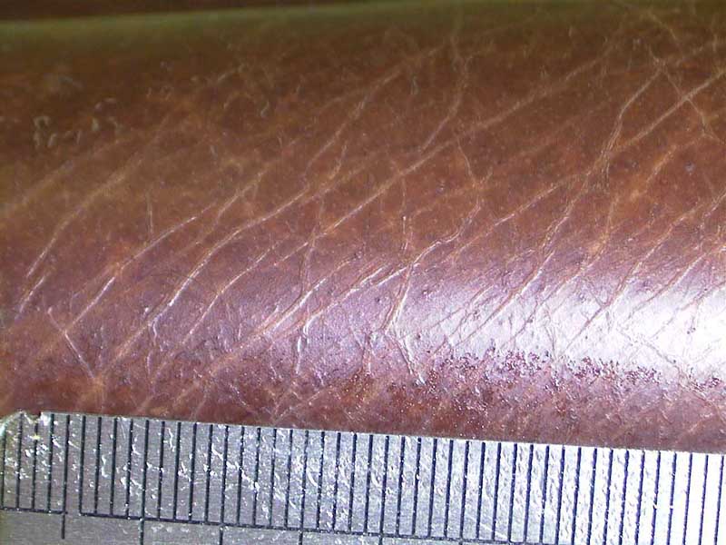 Onchocerciasis (River Blindness) - The Clinical Advisor