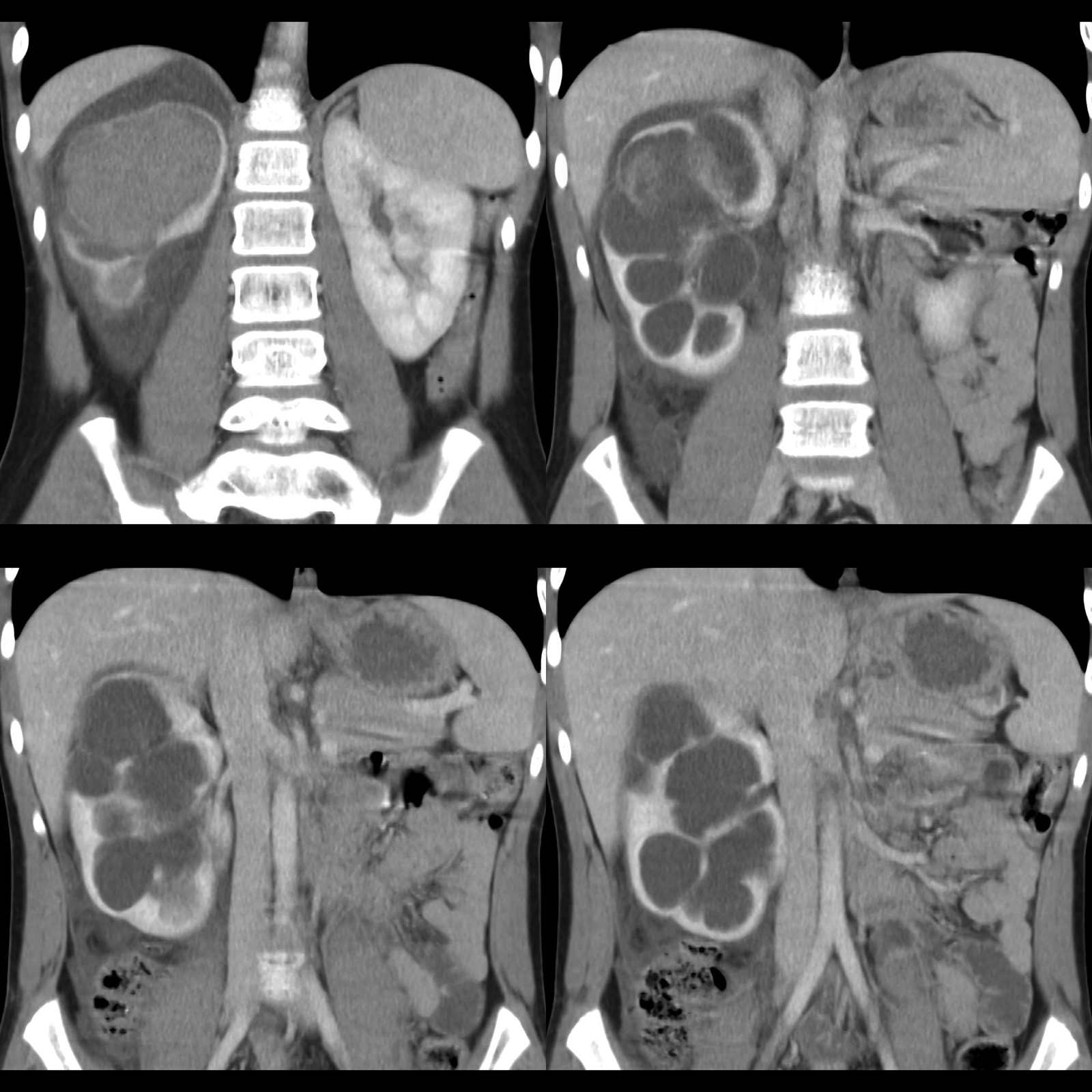 Renal Trauma - The Clinical Advisor