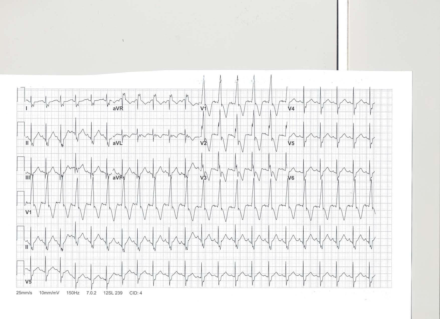 Tetralogy of Fallot - The Clinical Advisor