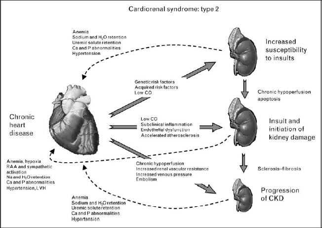 Cardio renal syndrome - The Clinical Advisor