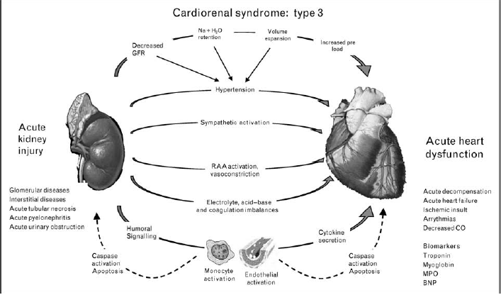 Cardio renal syndrome - The Clinical Advisor